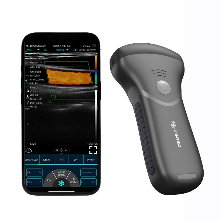 C10CT Pro USB&Wifi Convex Ultrasound Probe - Beijing Konted Medical ...