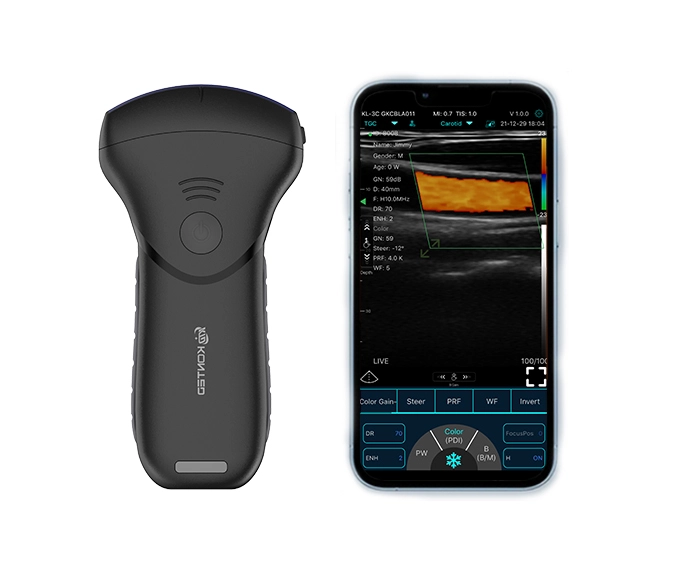 C10MT Pro USB&Wifi Convex Ultrasound Probe - Beijing Konted Medical ...