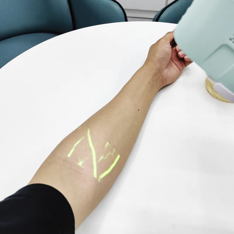 Vein Finder KT-10 - Beijing Konted Medical Technology Co.,Ltd.